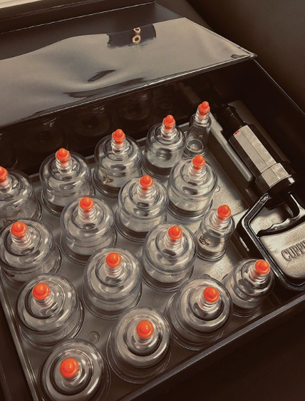 It’s cupping season!! - Springfield Physical Therapy & Wellness